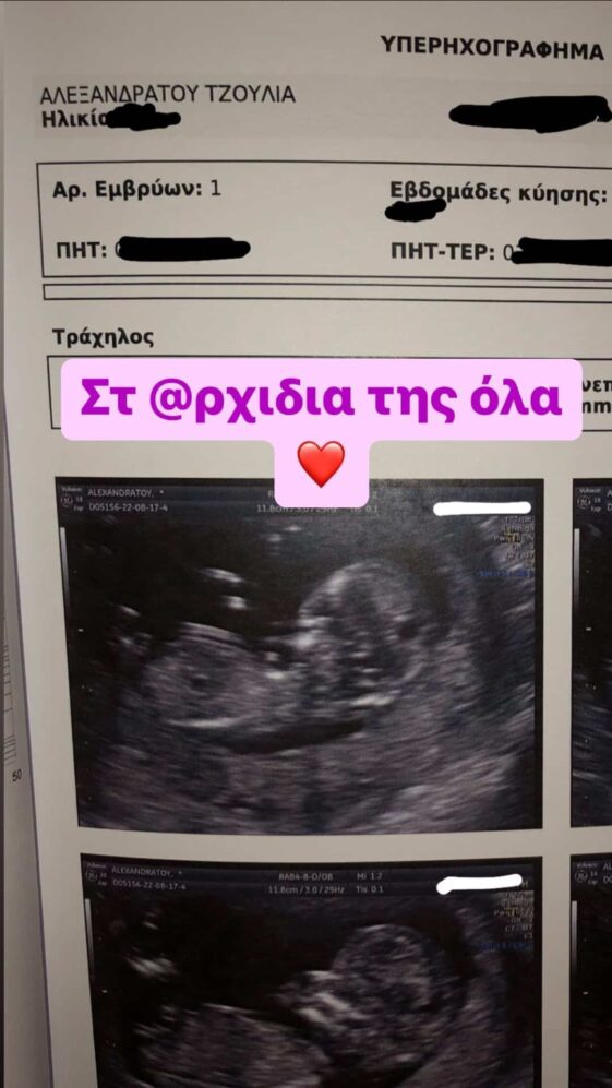 Τζούλια Αλεξανδράτου: ΣΤα @@ της ολα. Τα δείχνει στο onlyfans και σοκάρει στο instagram για το ...